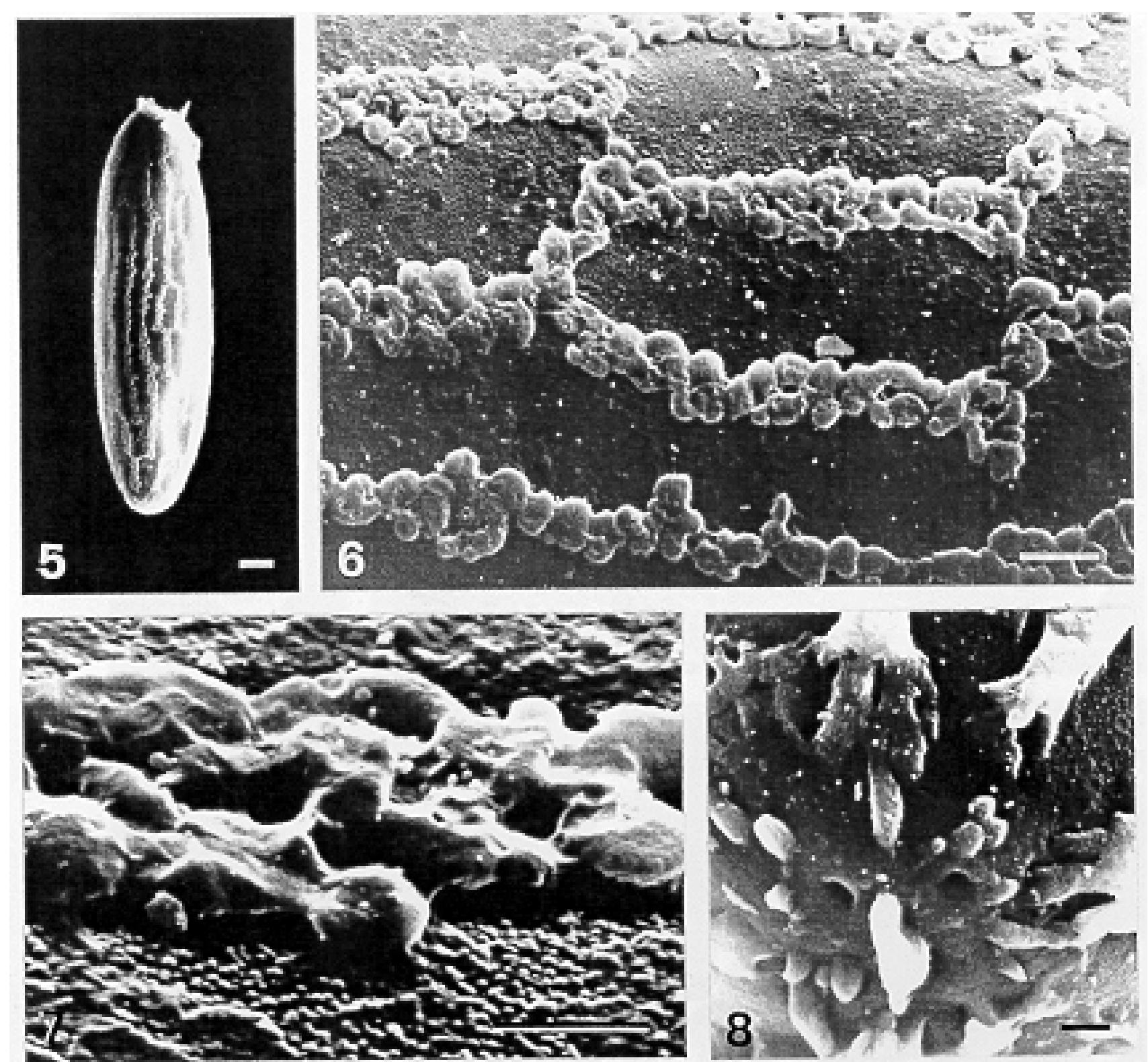 Figure 2 - from Ootaxonomic investigation of five Lutzomyia