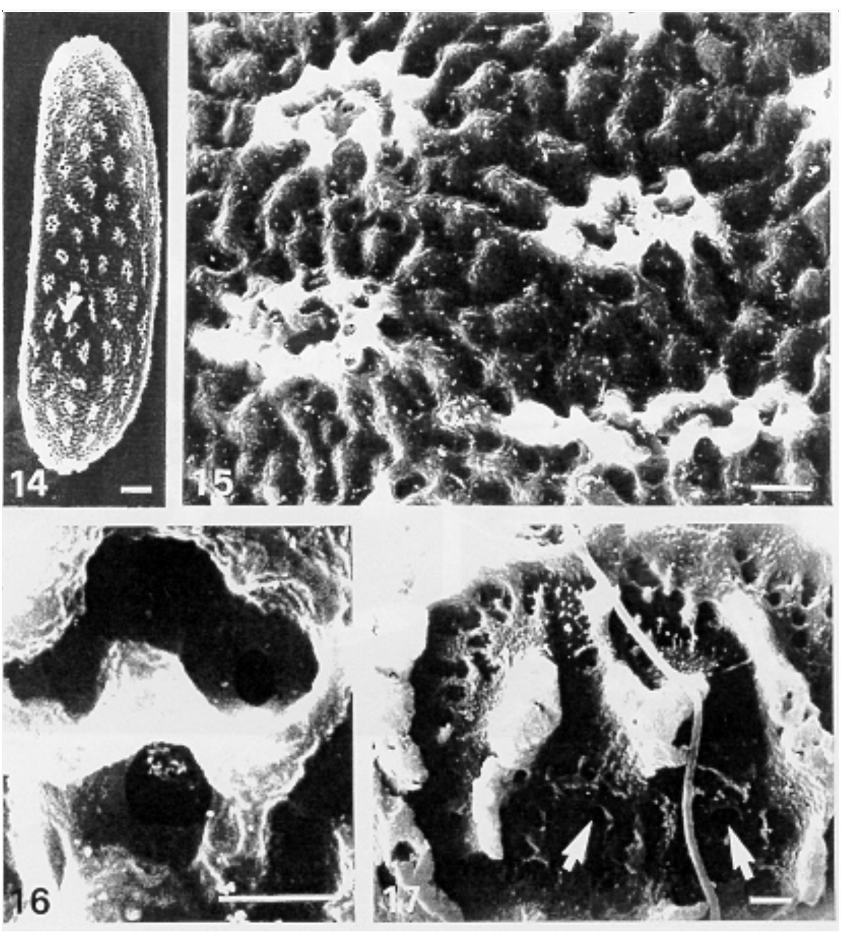 Scanning electron microscopy micrographs of an egg of