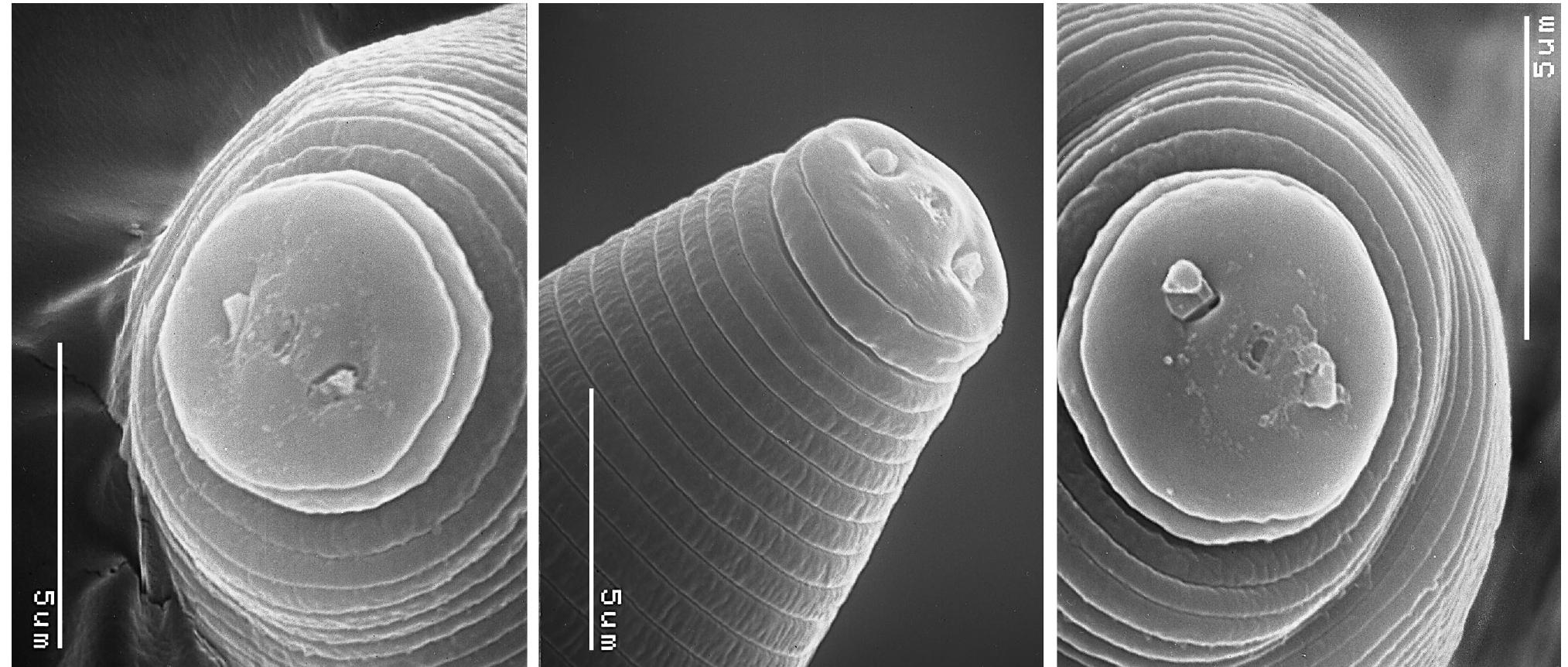 Sem morphology of pratylenchus speijeri n. sp. left and