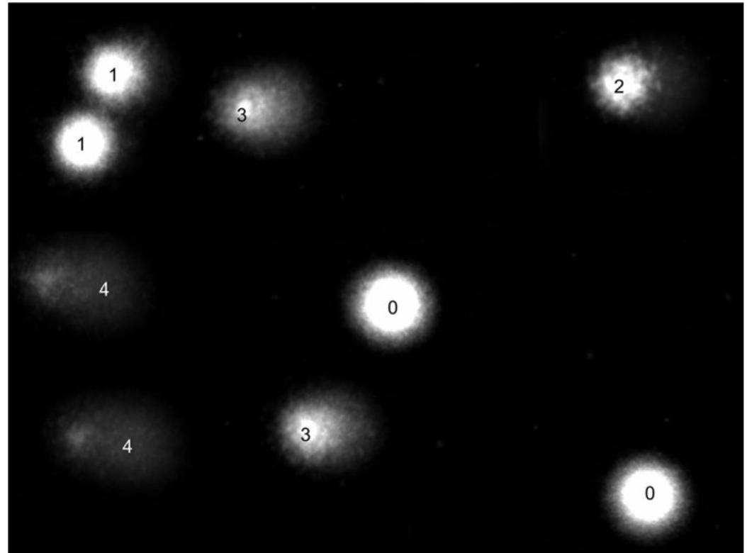 Examples of comets, from human lymphocytes. numbers indicate