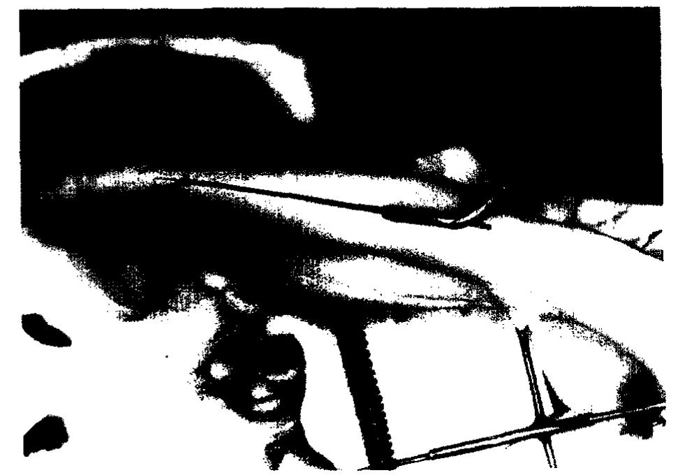 The inferior border of the mandible is viewed. the blade is