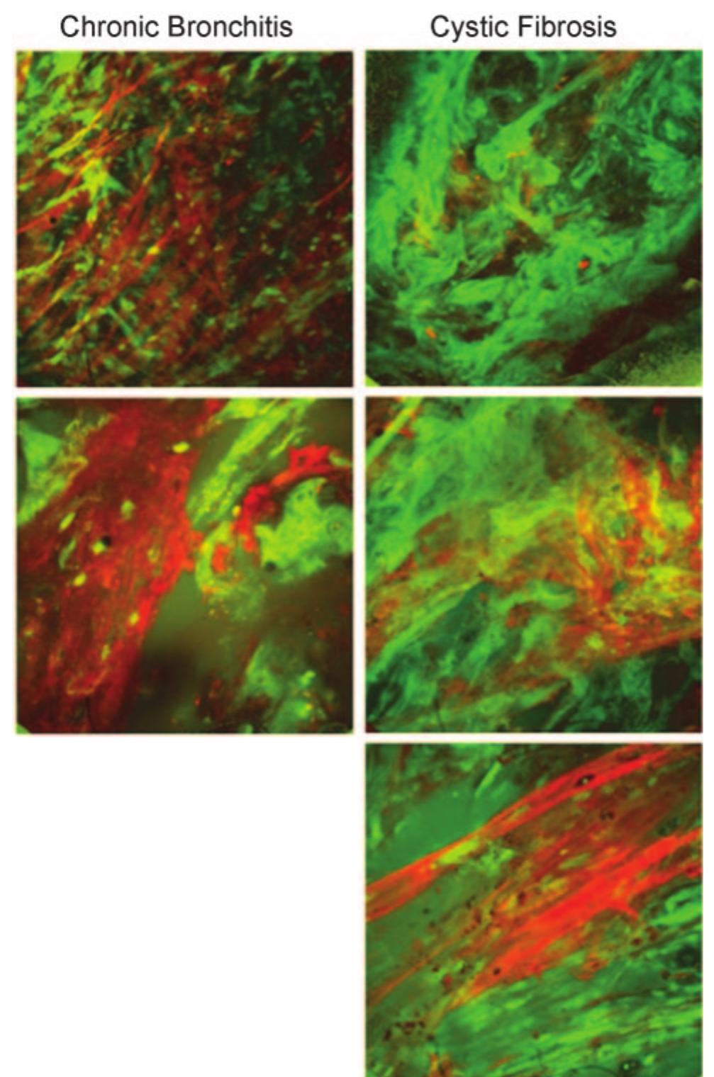 Laser scanning confocal micrograph showing the mucin