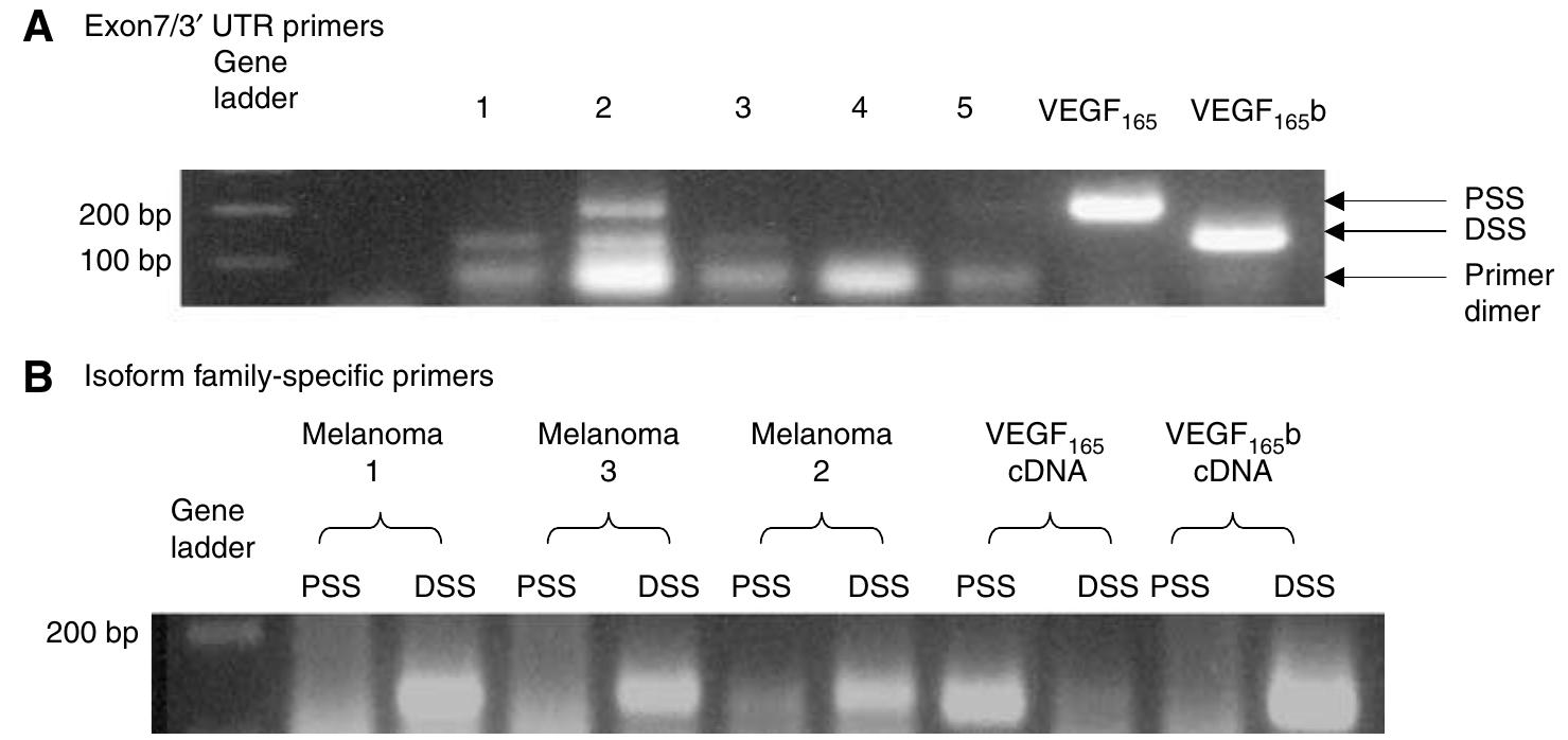 Distal and proximal splice variants of vegf are found in