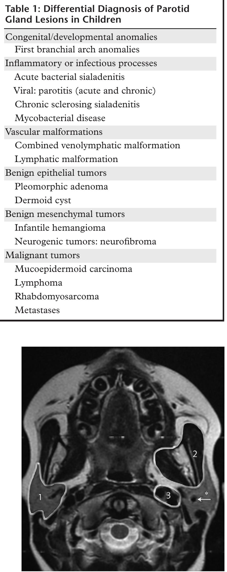 Normal radiologic anatomy of the parotid space. axial