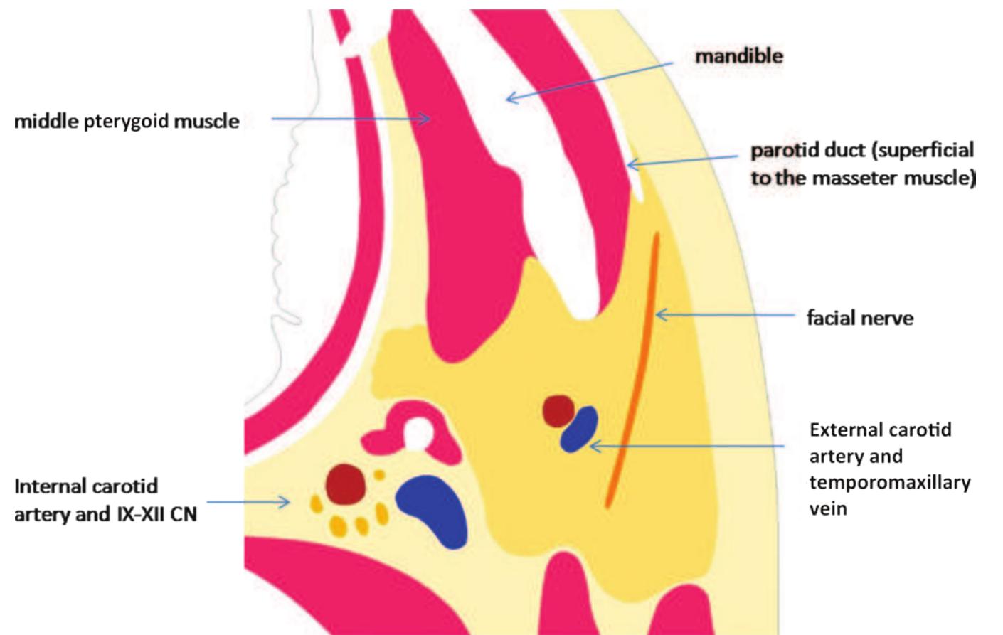 Axial anatomic section through the parotid gland shows the