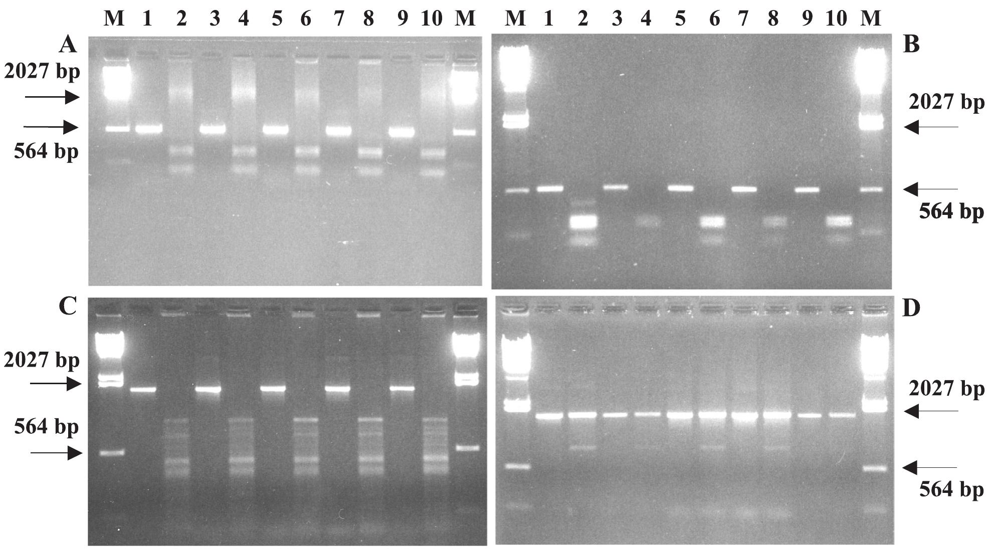 Agarose gel electrophoresis of pcr-amplified rdna products