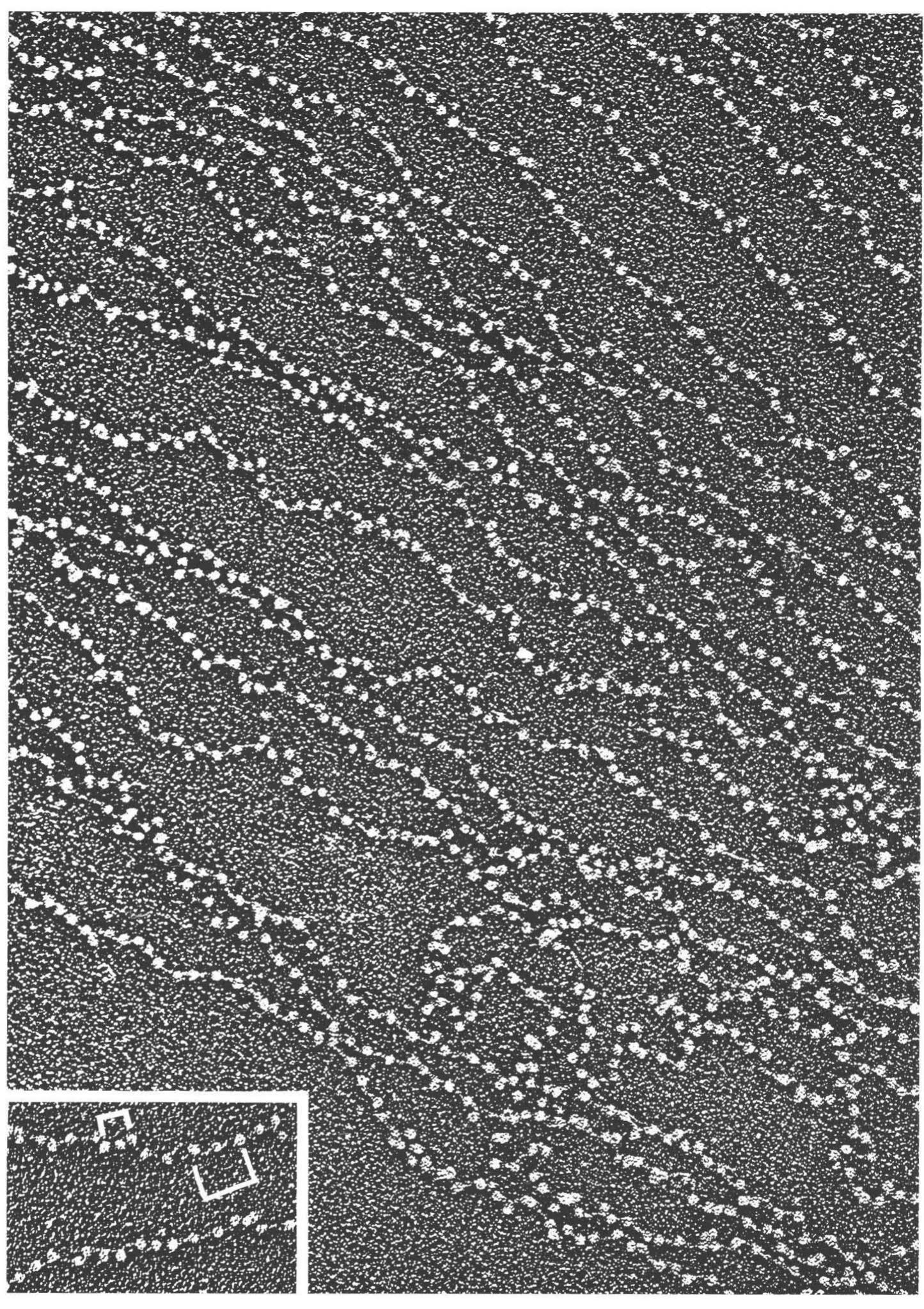 Survey electron micrograph showing the appearance of hen