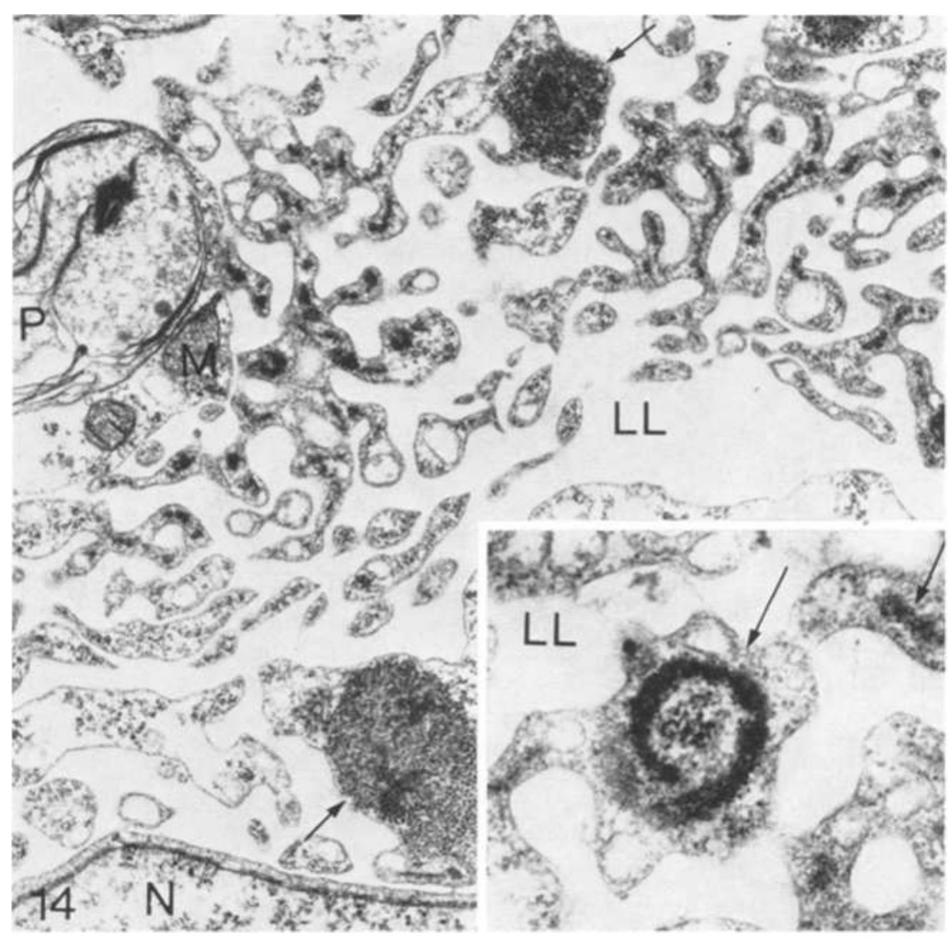 Radial Cross Section Of The “reticulate Zone” Of The
