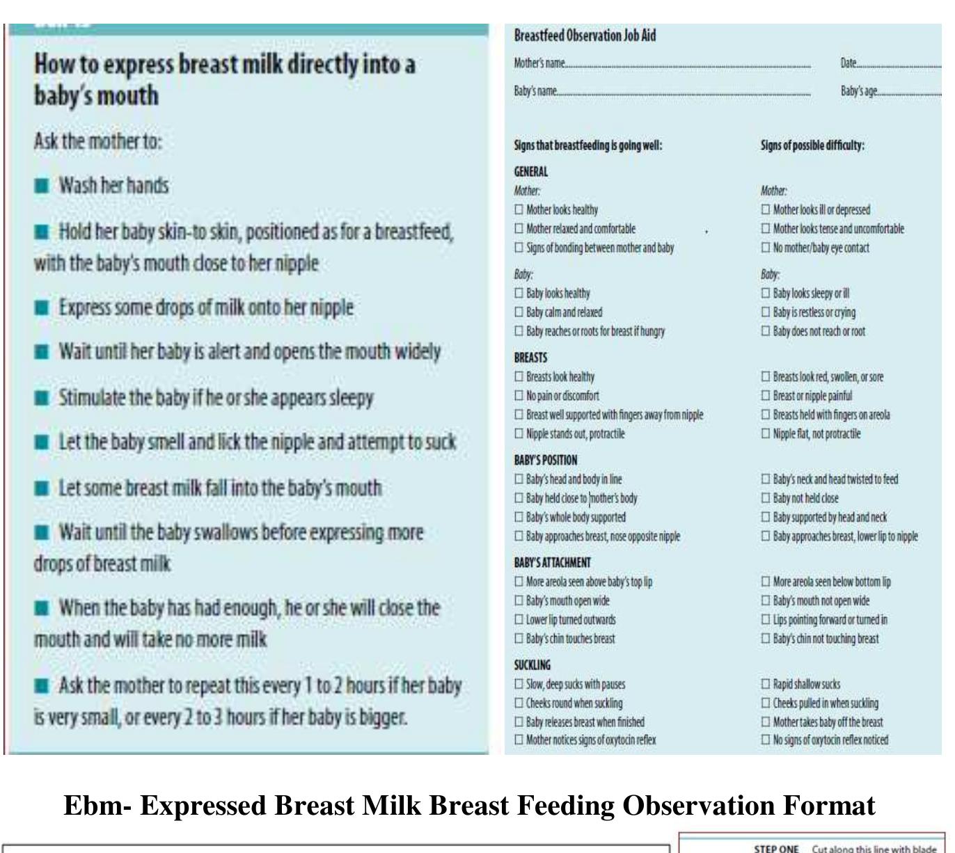 “lactational mastitis & breast abscess management, an