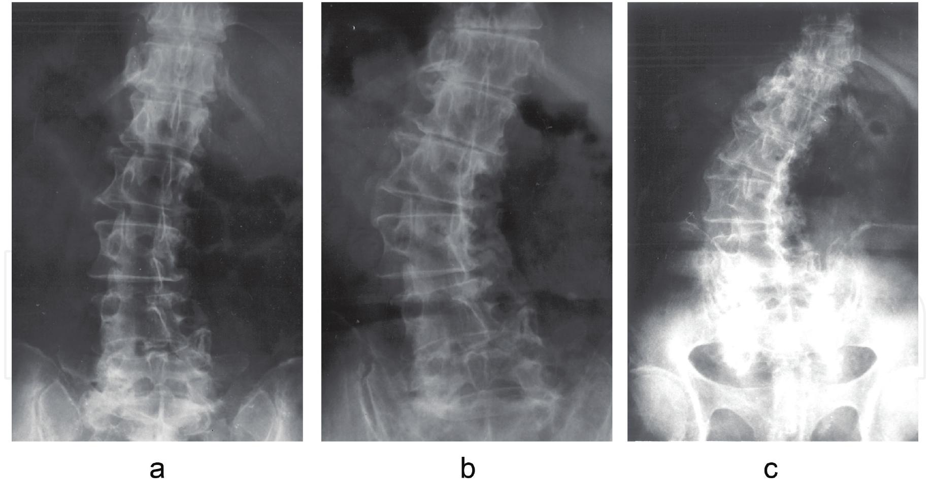 Figure 3 - from Physical Rehabilitation in the Management of