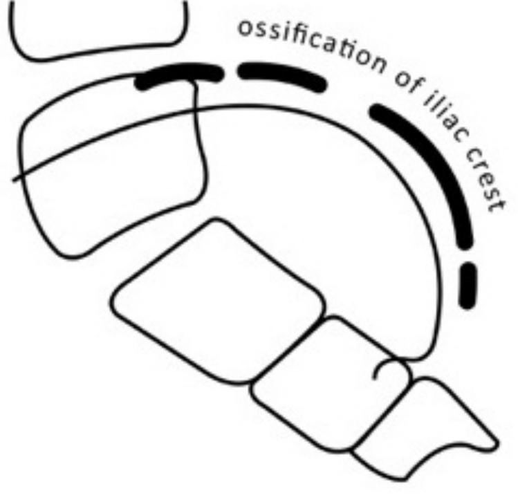 (7). ossification of the posterior iliac crest is more