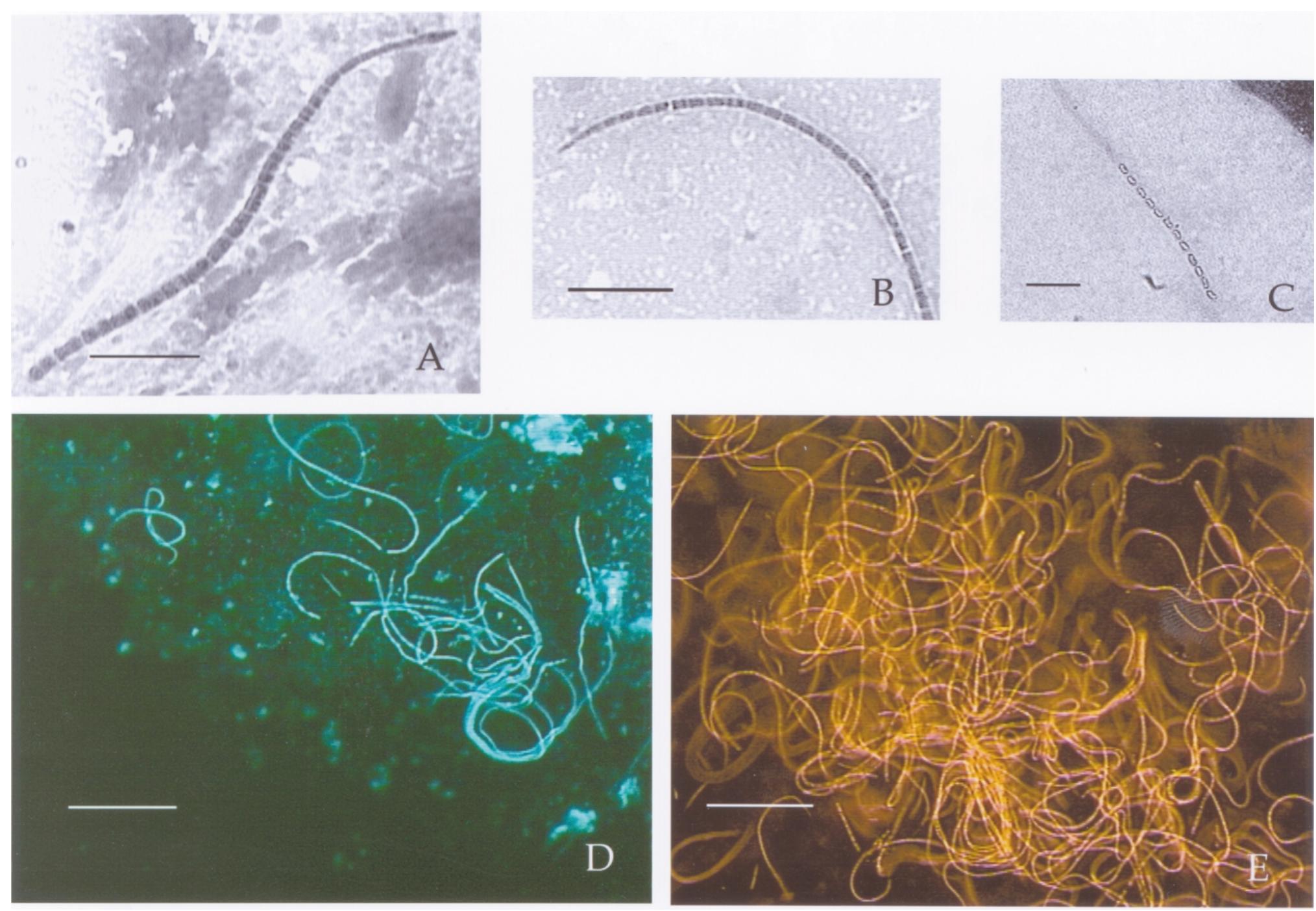 Gram stain and fluorescence in situ hybridization of