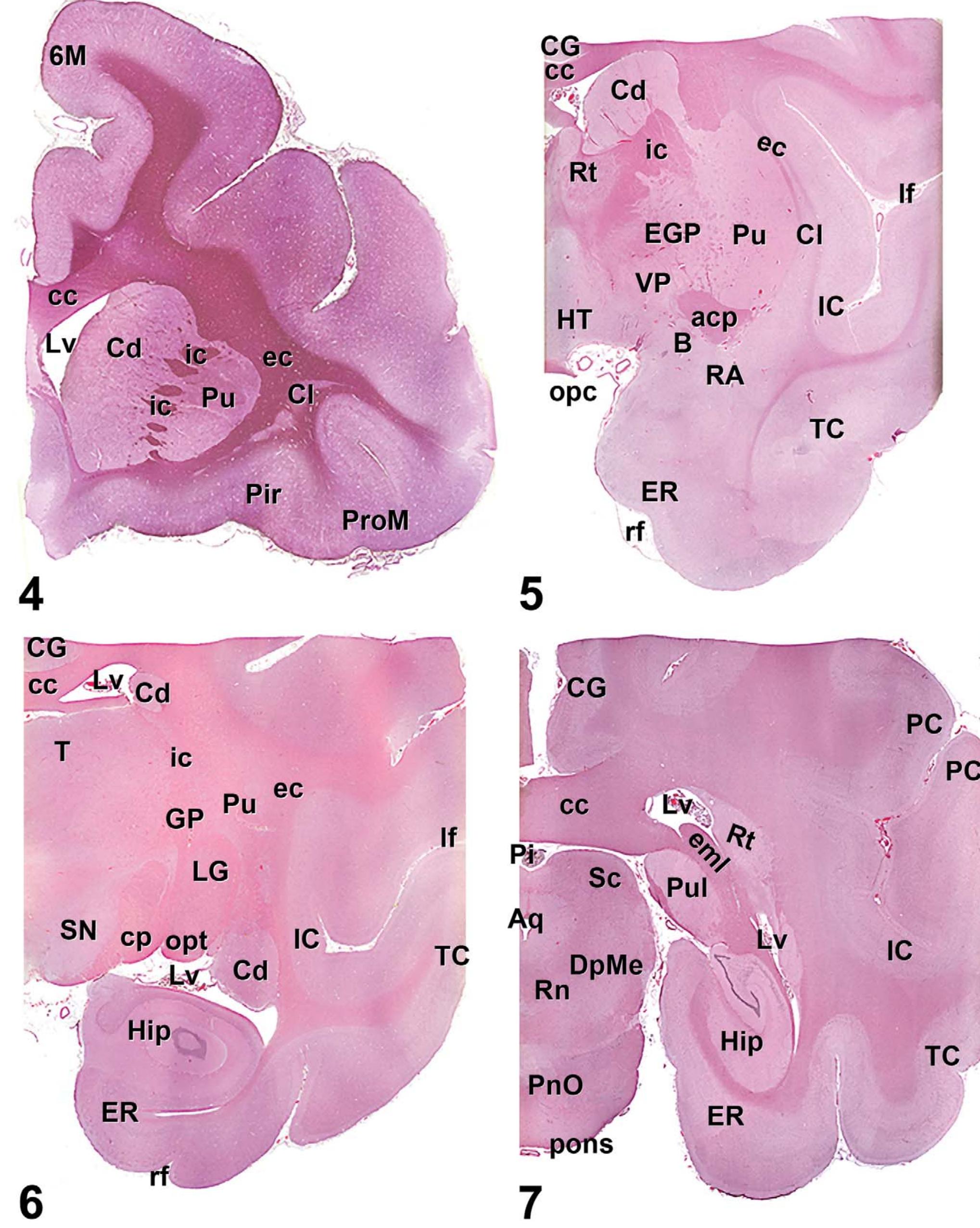 Ficure 4.—hematoxylin and eosin cross section of the