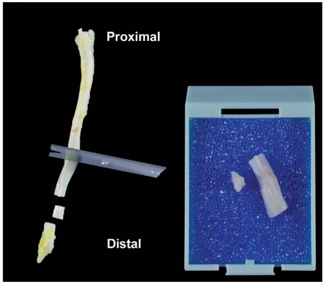 Ficure 14.—longitudinal and cross-sections of the sciatic