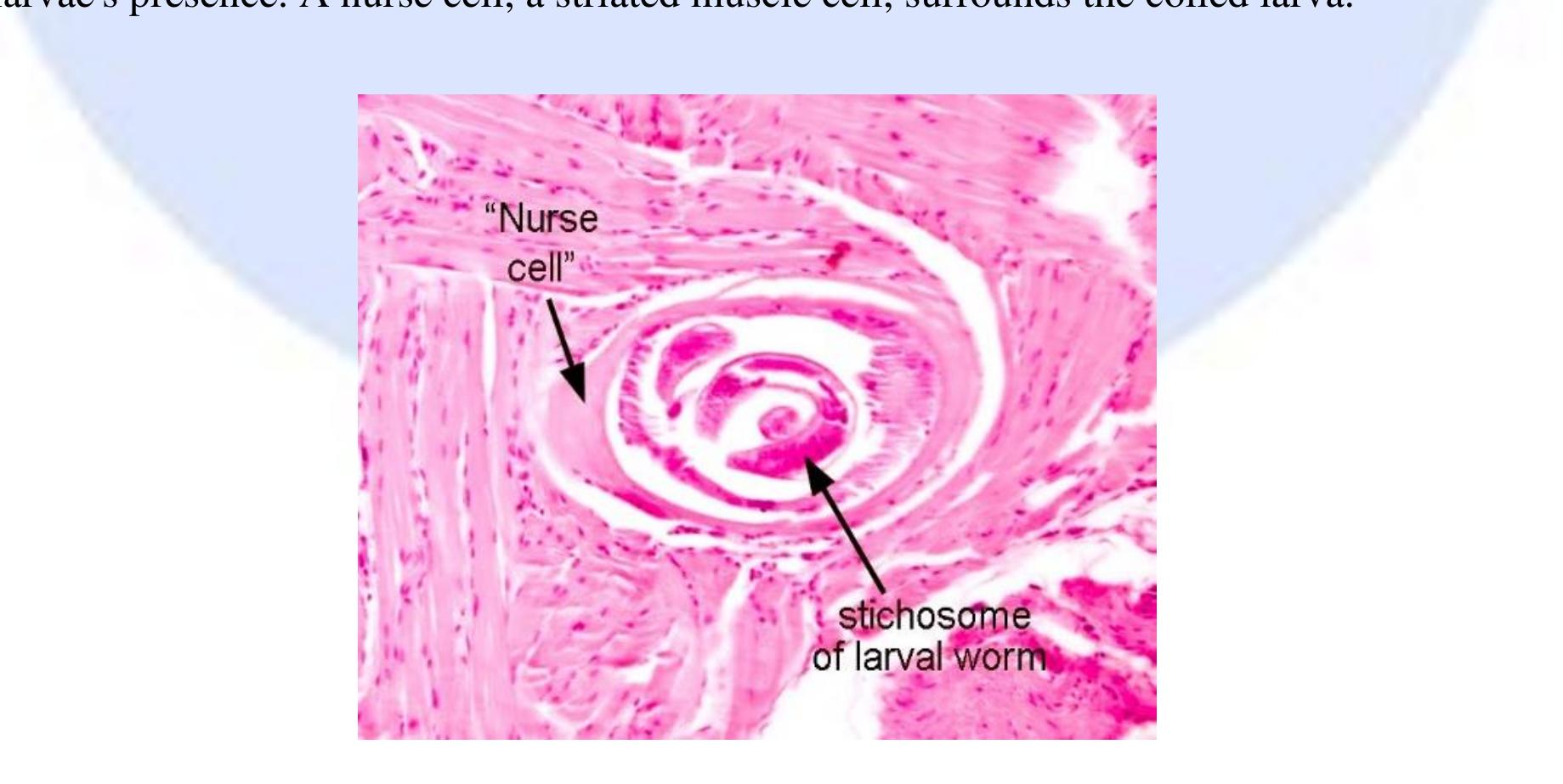Figure 1 - Trichinella spiralis