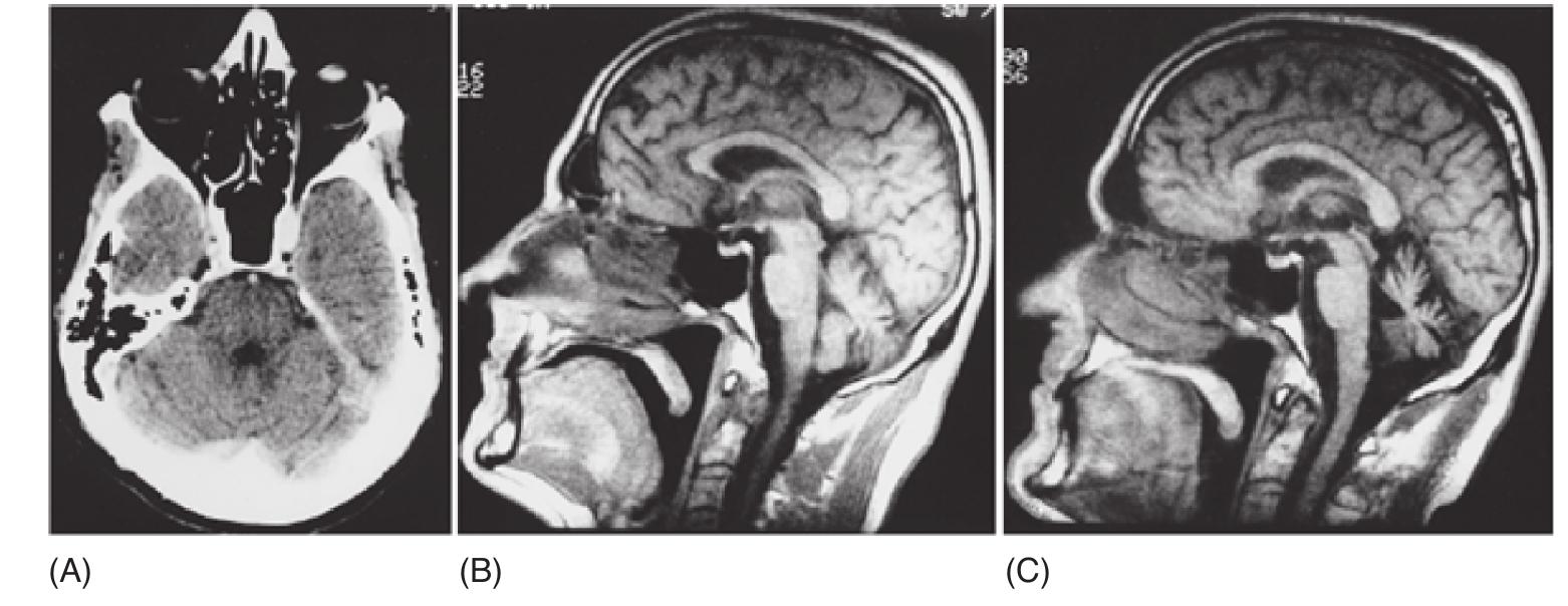 Computer tomography (ct) scans of a 45-year-old man that