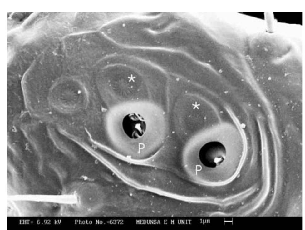 Enlarged view of the antennal sensilla coeloconica of