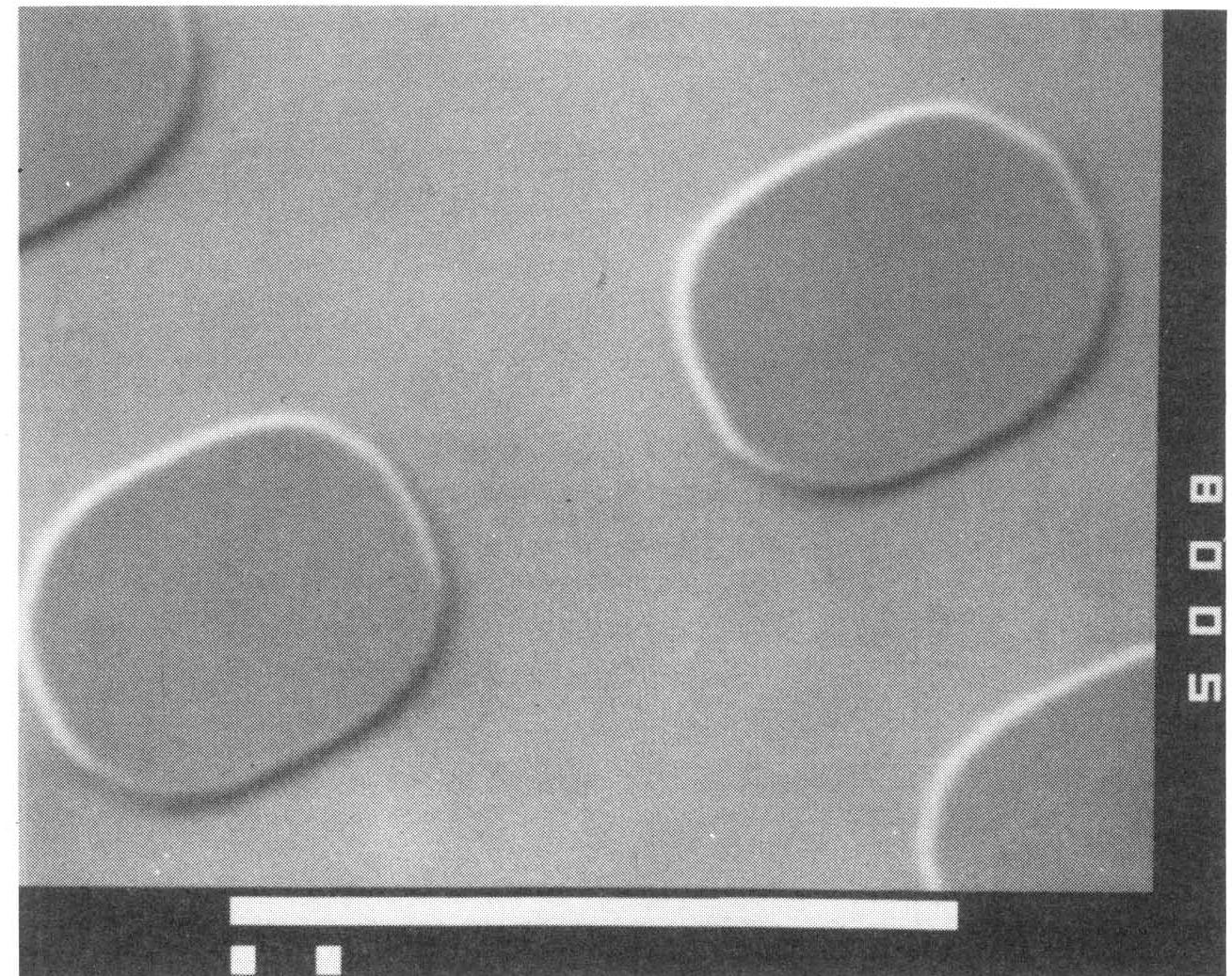 Mesa structures of dimensions 6 x 6m etched in a recipe