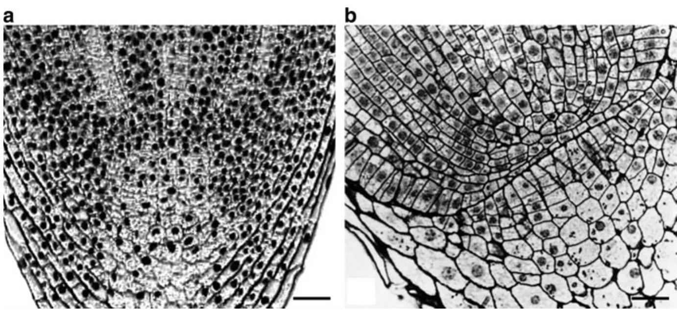 Longitudinal sections through the root tip of (a) allium