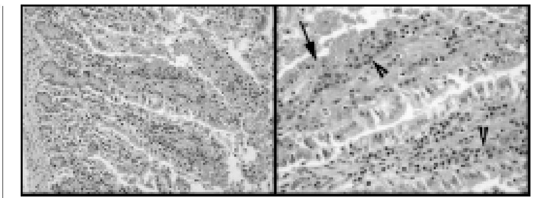 Necrosis and inflammation of the small intestine (left);