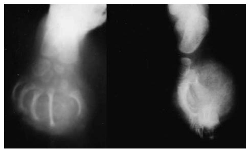 antero-posterior and lateral radiograph showing the