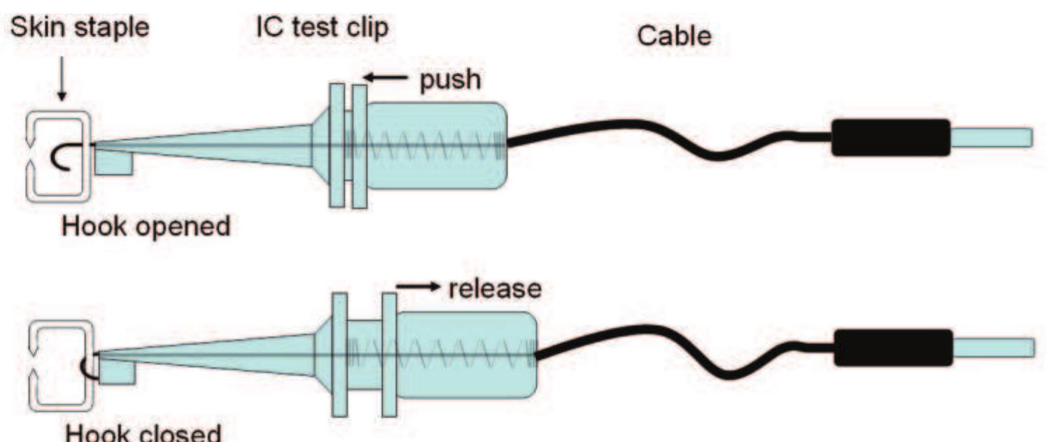 Fic. 1. schematic illustration of the staple electrode