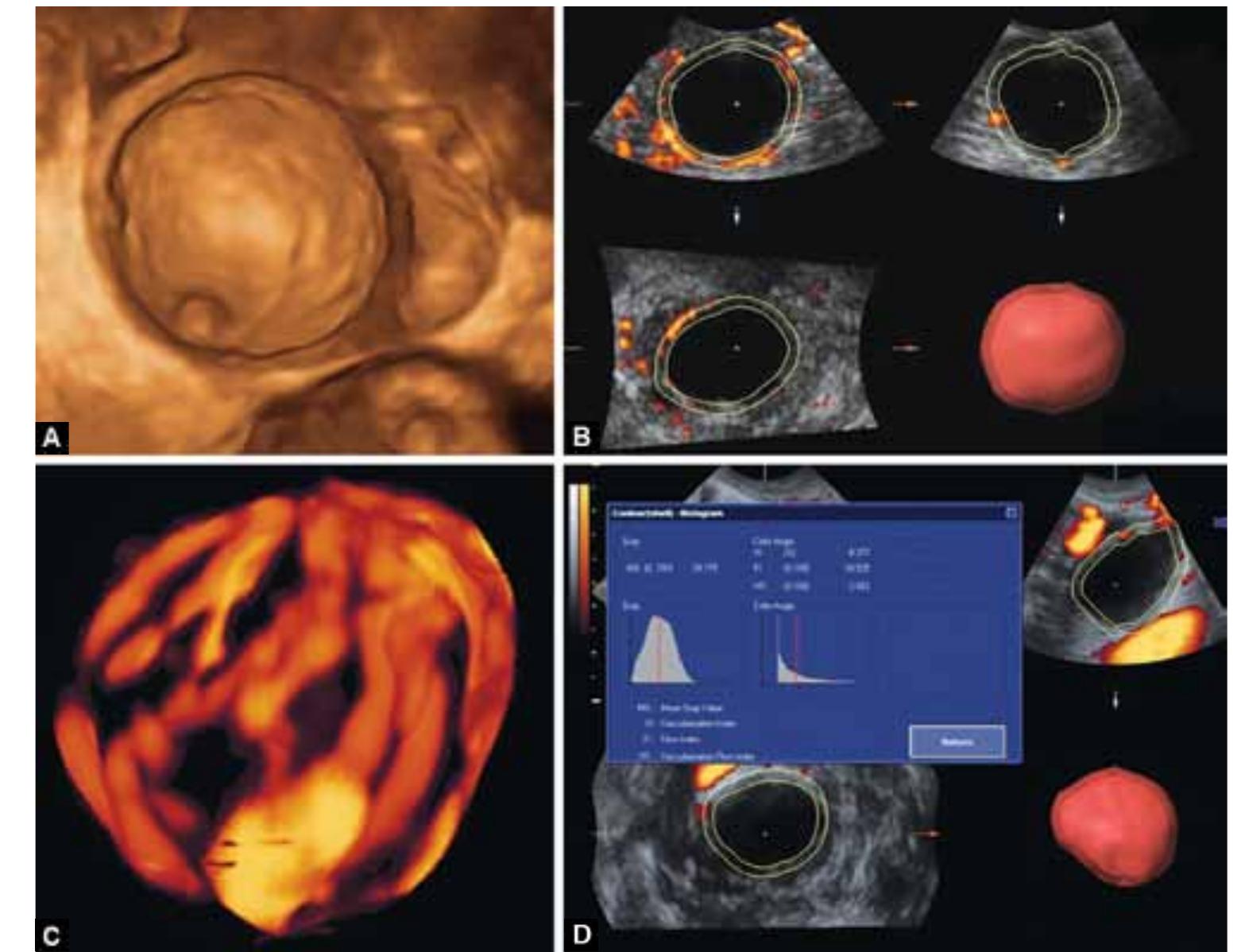 S 11a to d: (a) cumulus oophorus in follicle on 3d us of