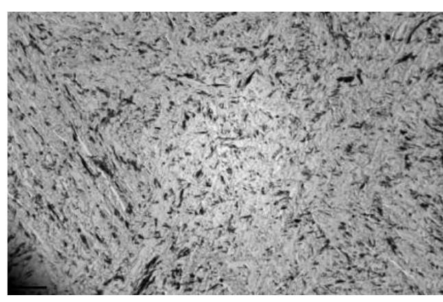 A: replica of the microstructure of aisi 15b41 steel