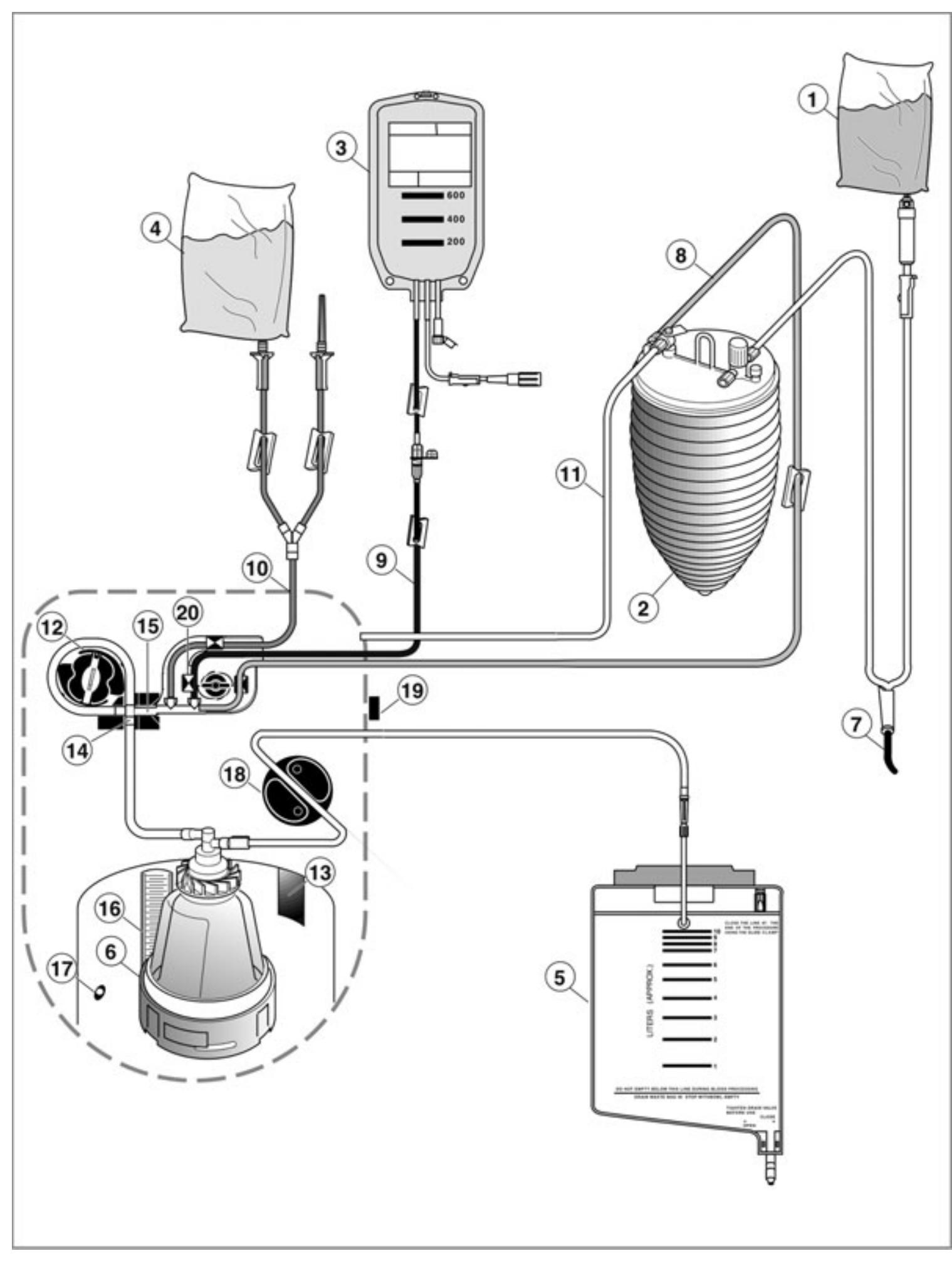 Schematic diagram of autotransfusion circuit for cell