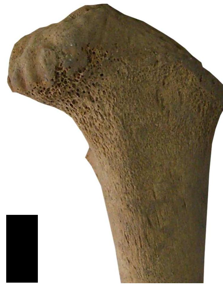Anterior view of the proximal end of the left femur dia-