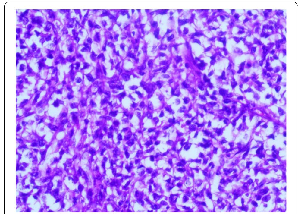 Microscopic images demonstrating the replacement of the