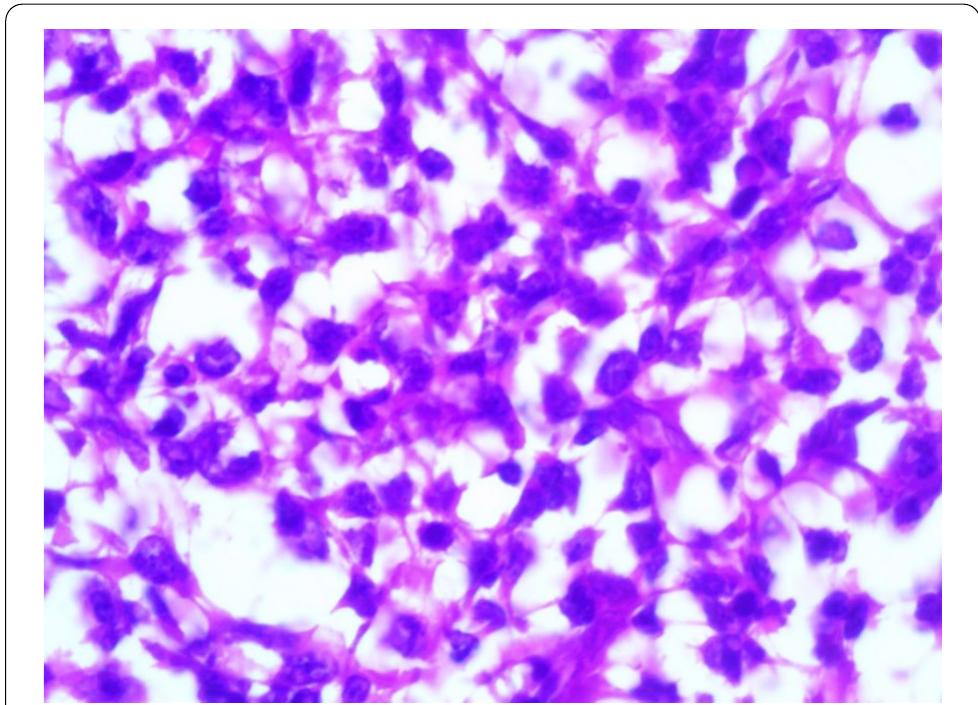 Microscopic images demonstrating the replacement of the