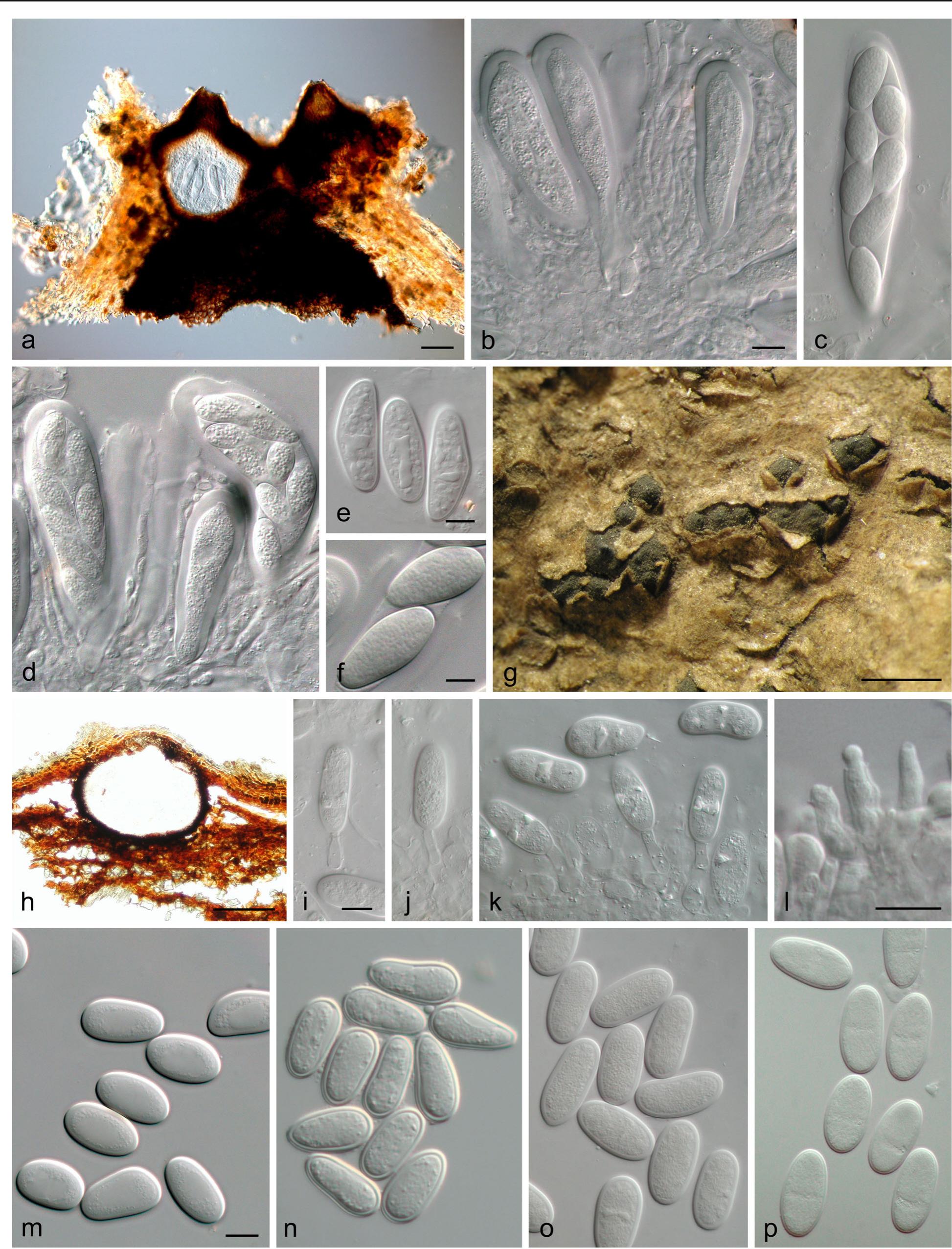 Aseptate conidia of bpi 599153. p hyaline, aseptate conidia