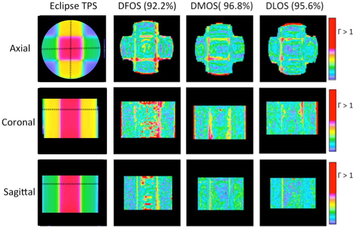 Treatment plan 2—gamma maps. three orthogonal views of