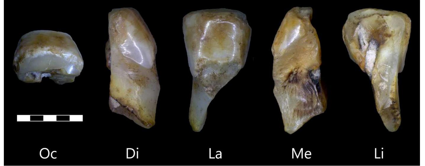 The ciemna | mandibular incisor in occlusal (oc), distal