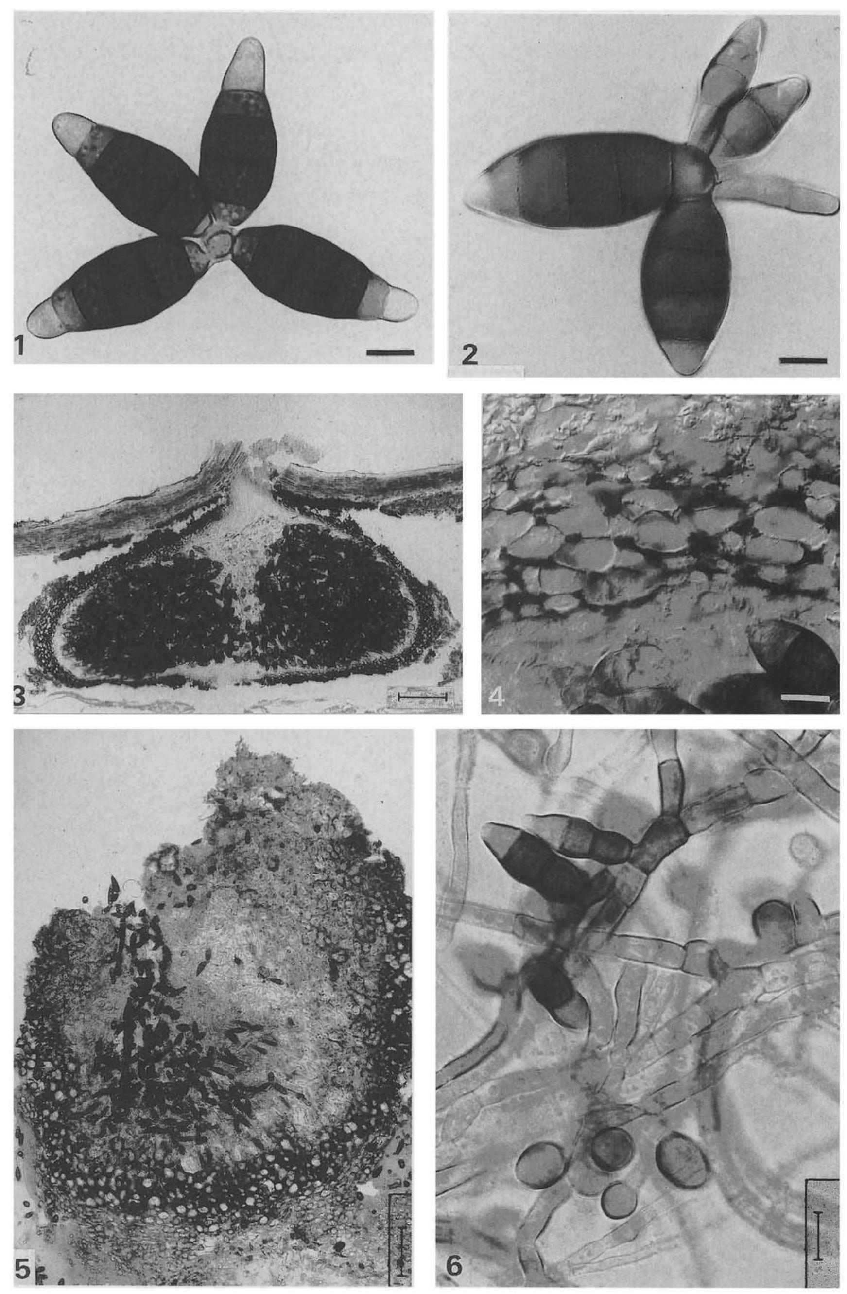 S 1-6. fig. 1. p. asterosporum conidium in water, bright