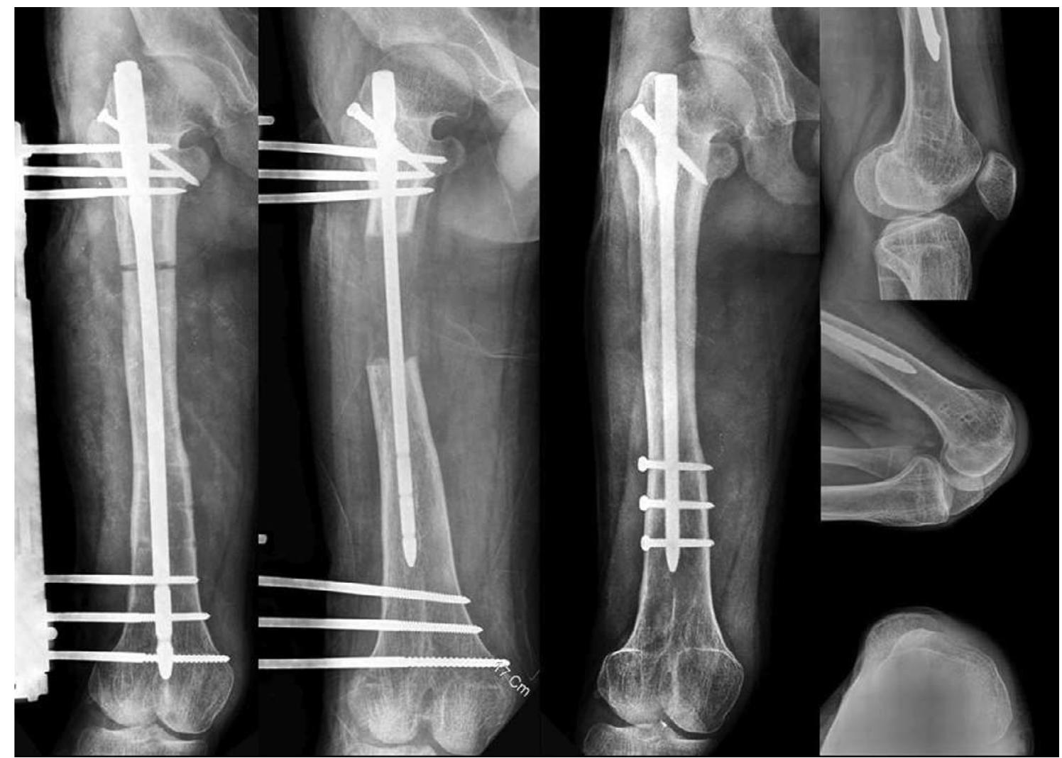 (case 22). the 16-year-old male patient underwent the