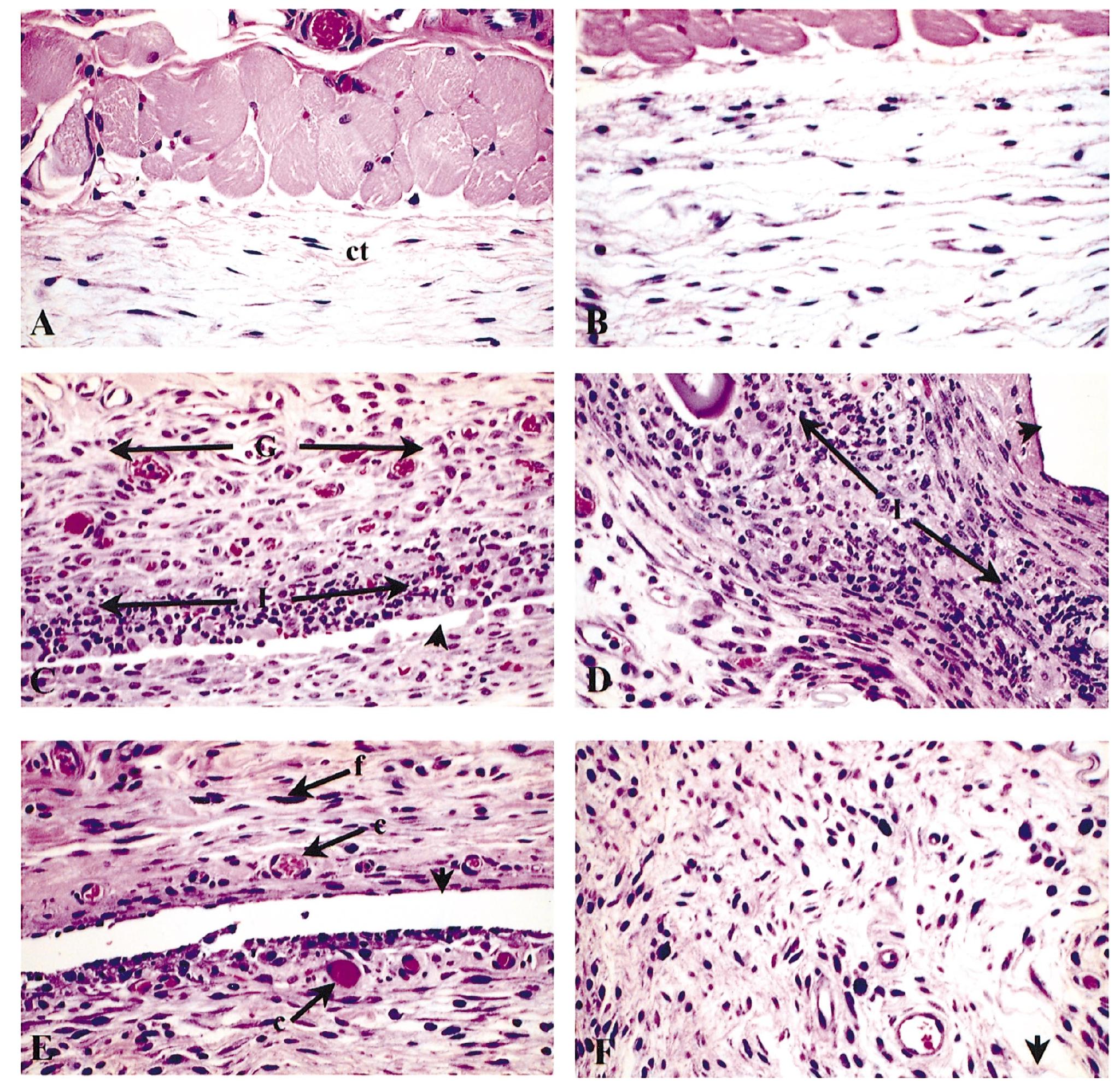 Photomicrographs of skin connective tissue sections from