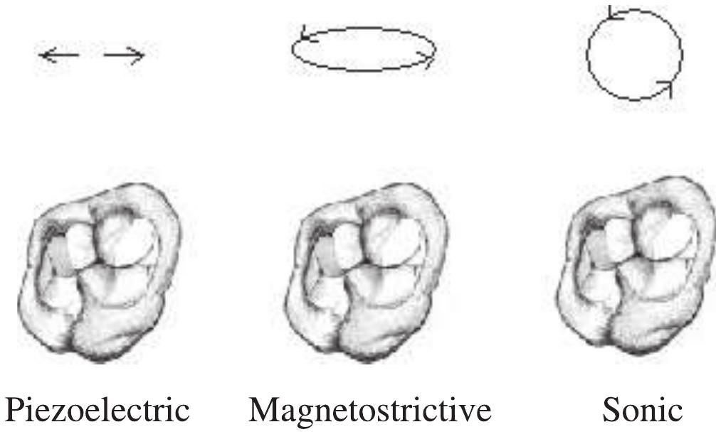 Tip movement orientation of sonic and ultrasonic scaler. en