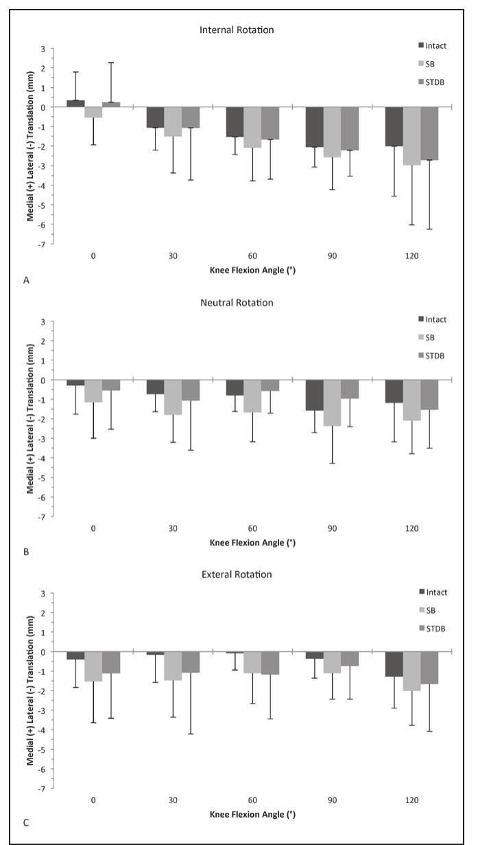 Mean medial-lateral tibial translation from a 150 n