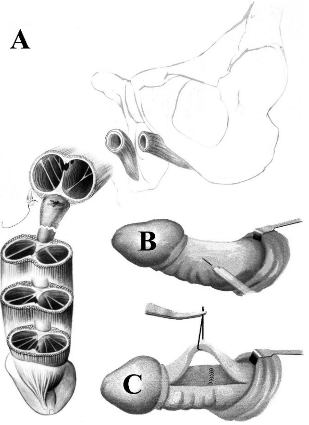 Schematic illustration of the surgical techniques. (a)
