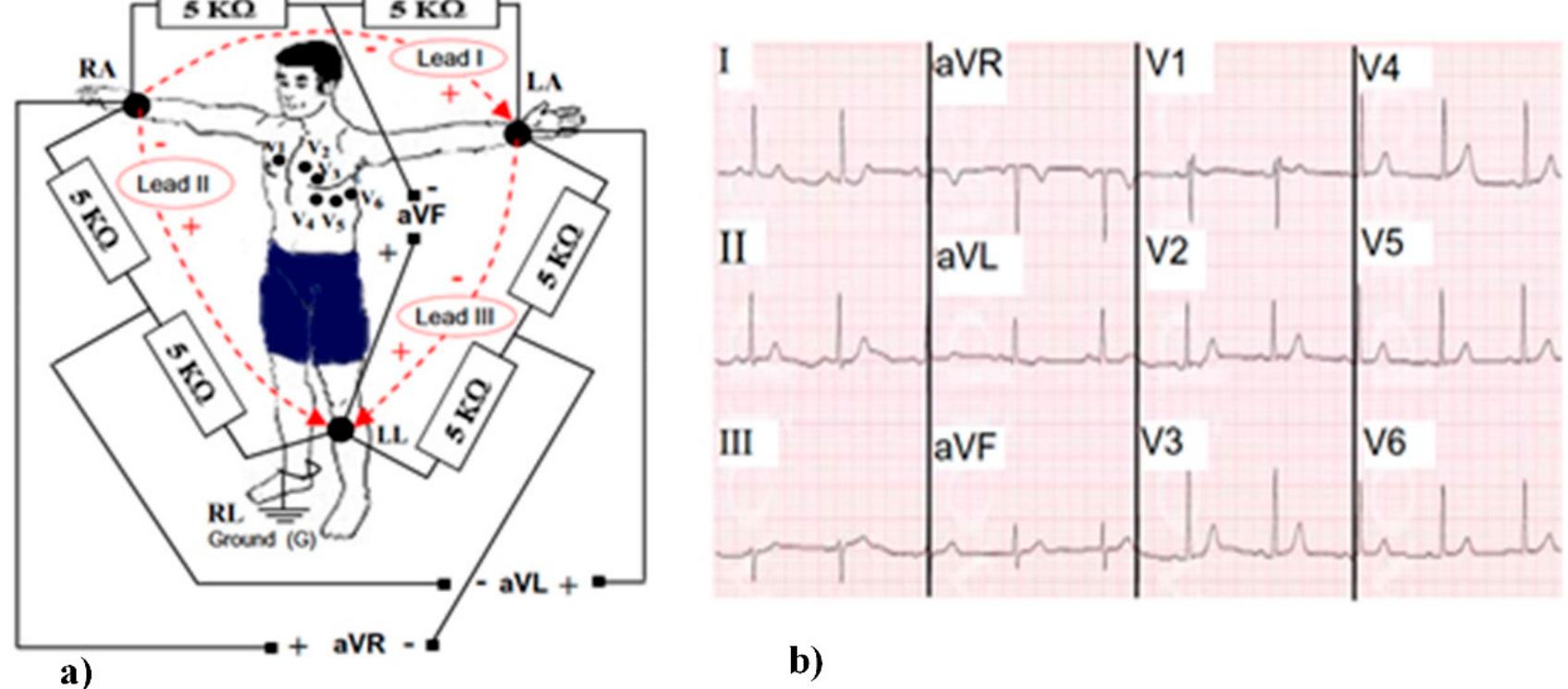 Schematic representation of electrocardiography (ecg) [69]: