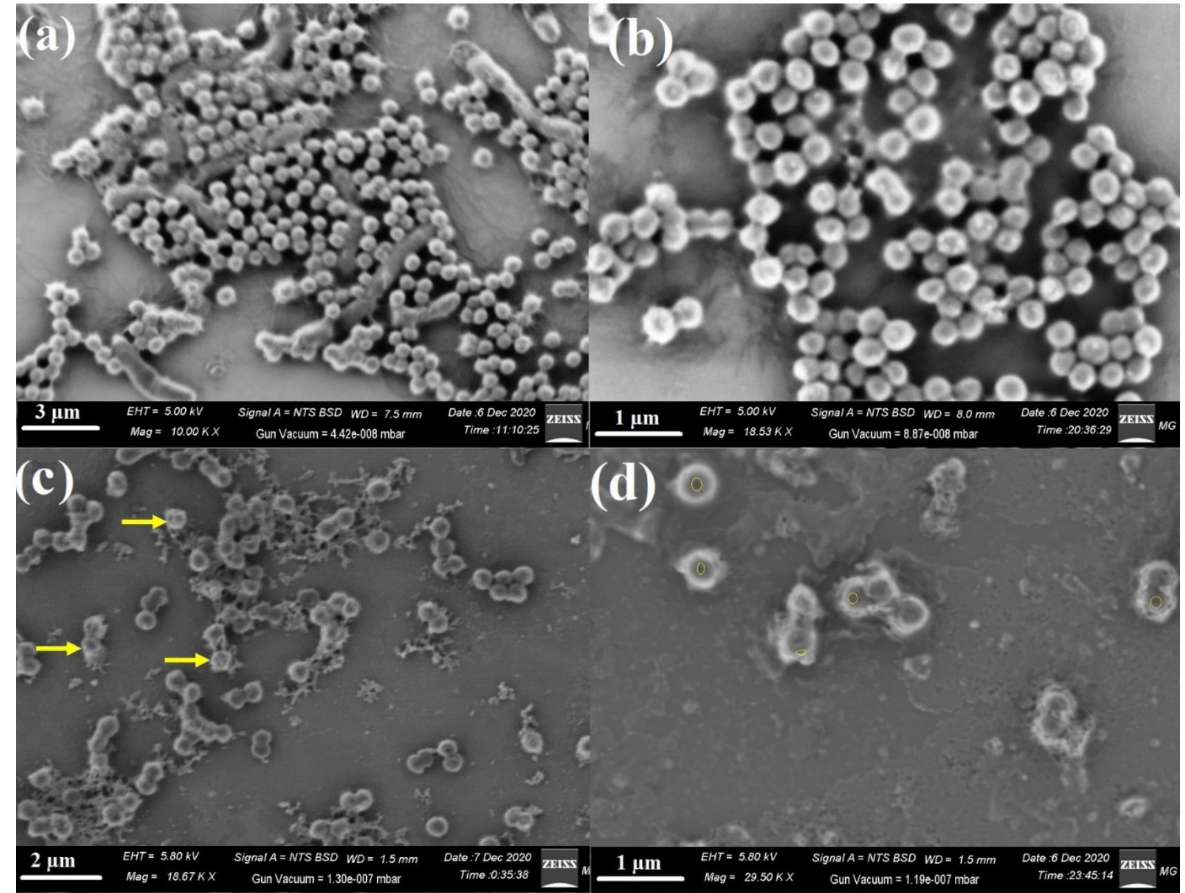 Sem images of s. aureus; (a) regular bacterial cells (s.