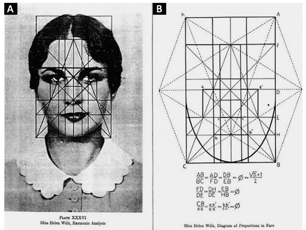 Profile angles: nasofrontal angle (a), nasolabial angle (b)