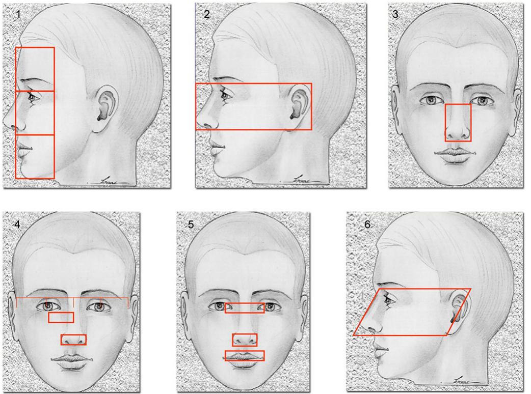 Profile angles: nasofrontal angle (a), nasolabial angle (b)