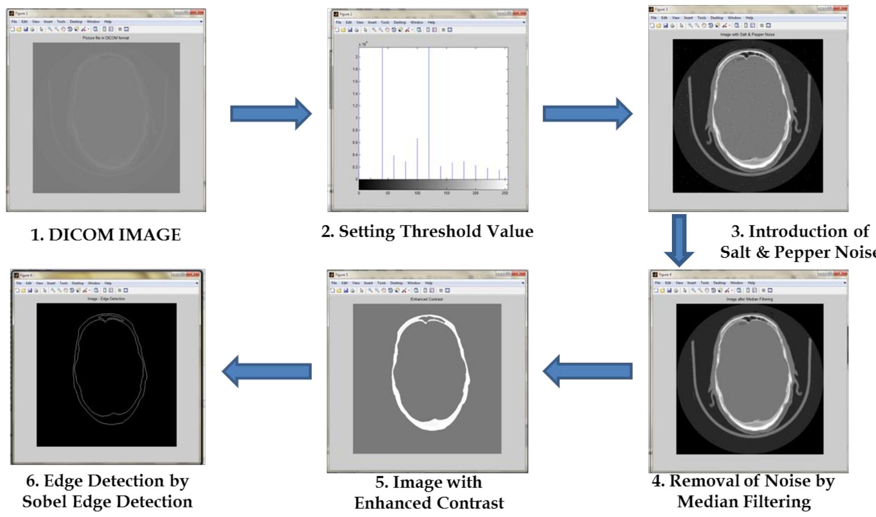 No. 3 image processing of ct scan fig. 2 shows flow chart