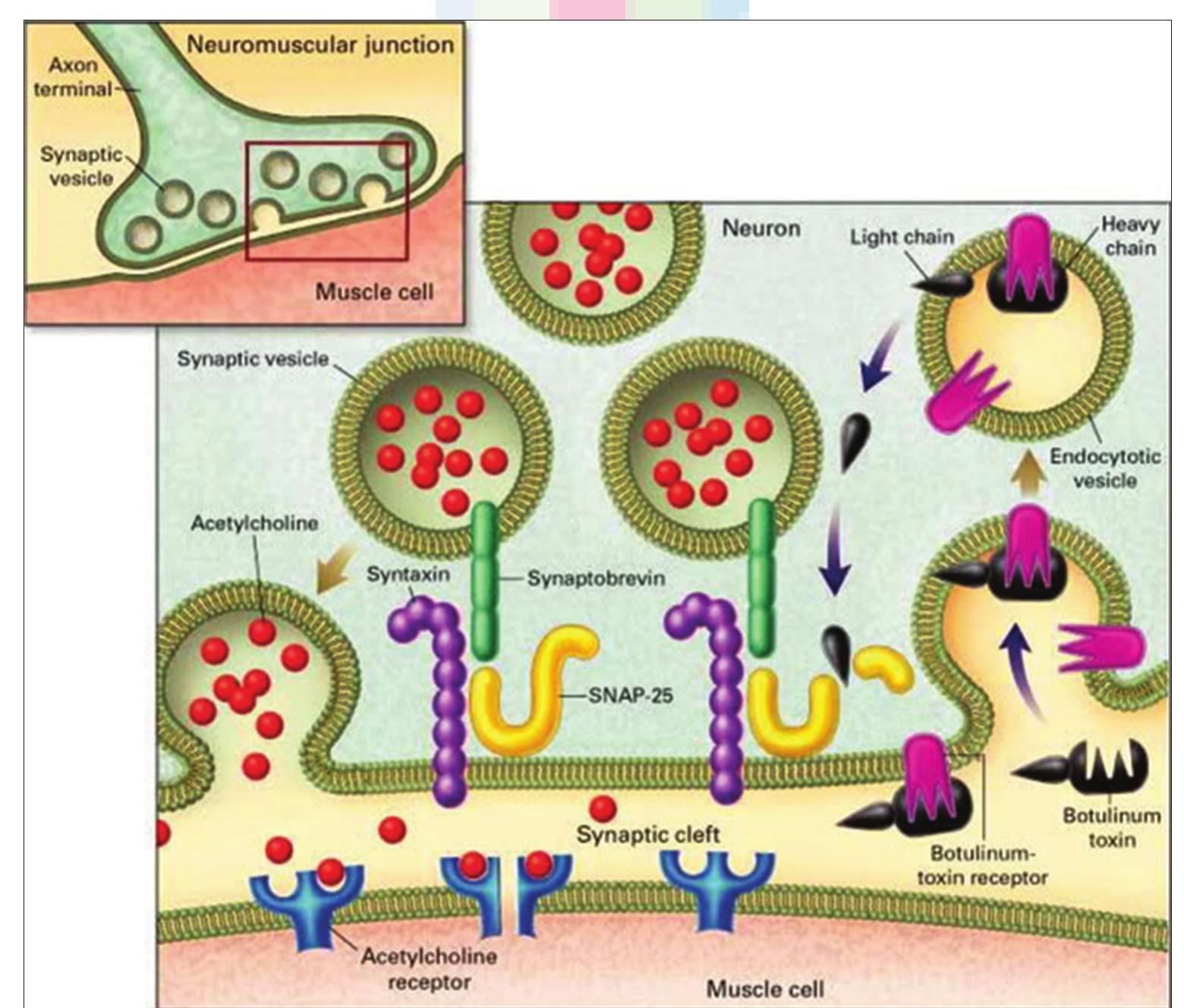 Mechanism of action of botulinum toxin for muscles affected