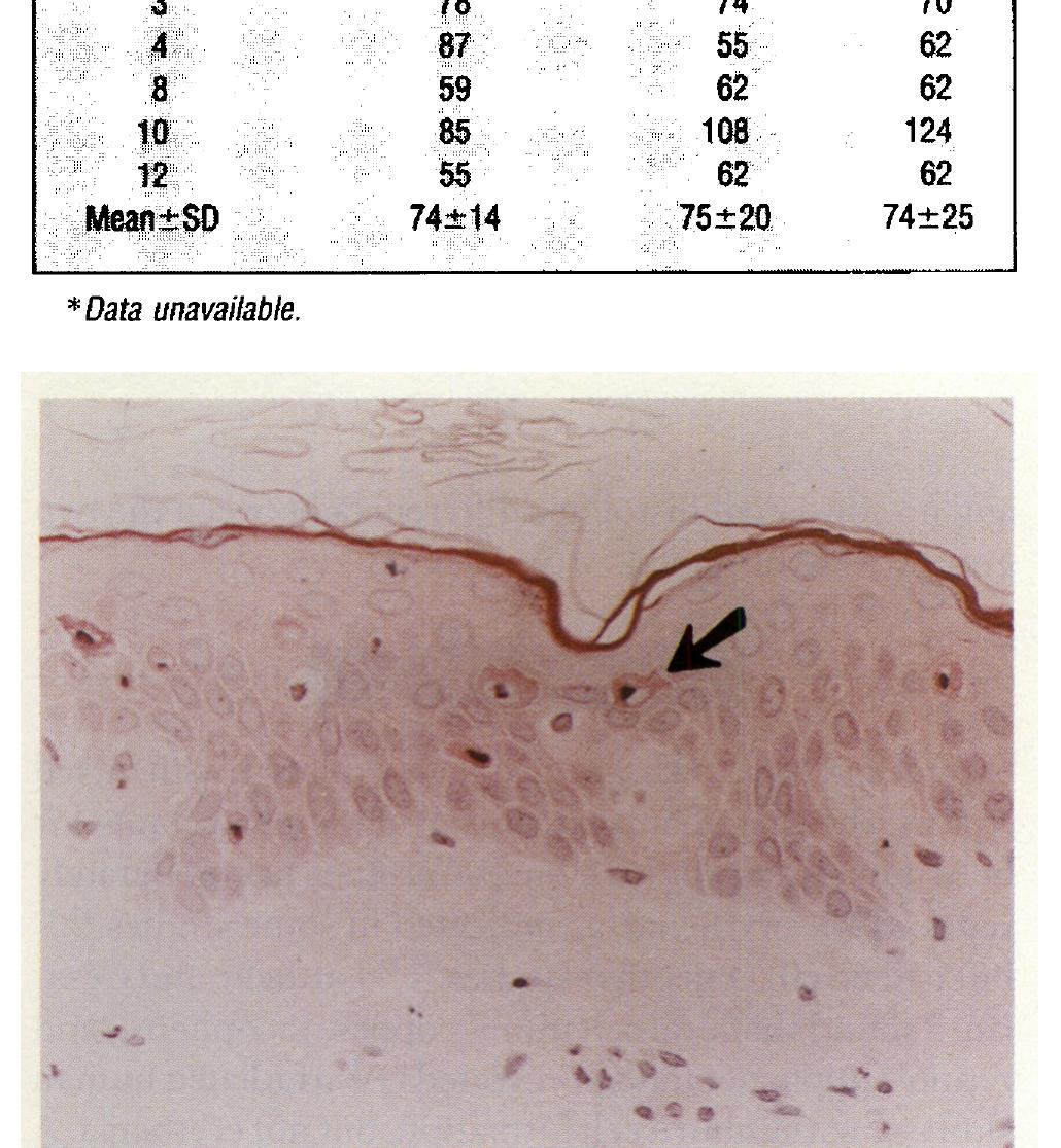 Histologic appearance of the skin 24 hours after a threefold