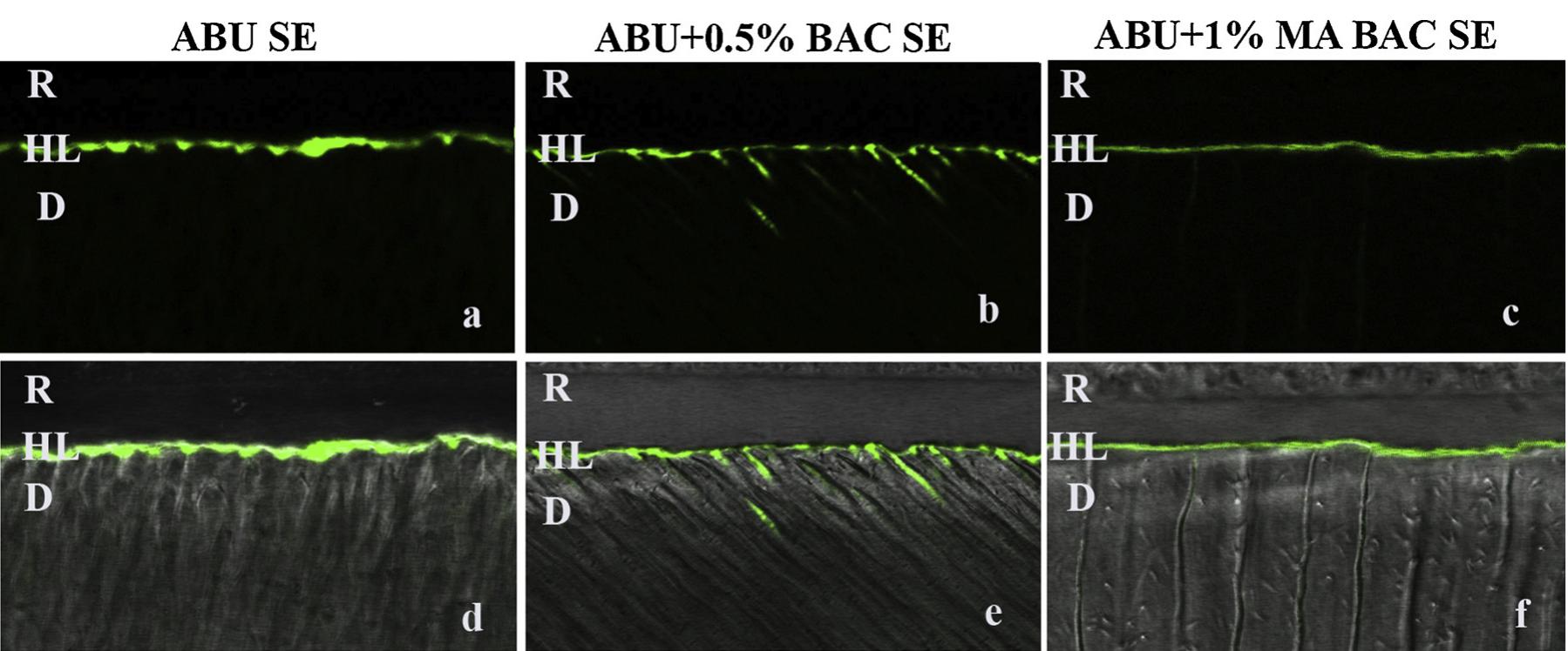 Resin-bonded radicular dentin interfaces prepared with abu