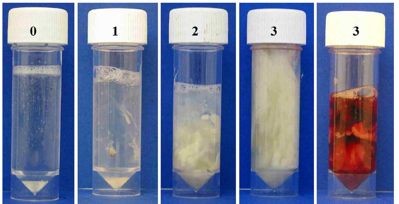 Typical samples of vaginal mucus character: score 0 = clear